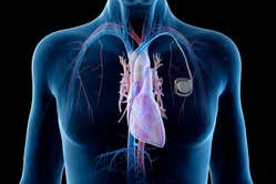 Implantable battery is charged up by the body’s oxygen supply – modern ...